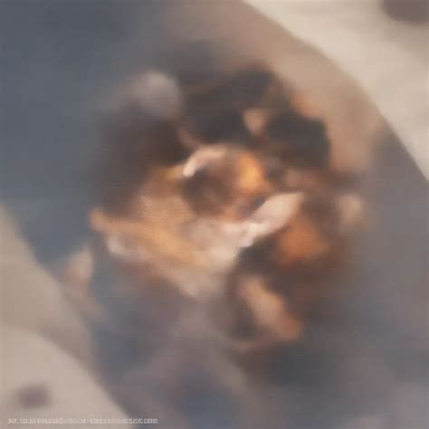 Understanding Bardet Biedl Syndrome Genetic Componentswebp