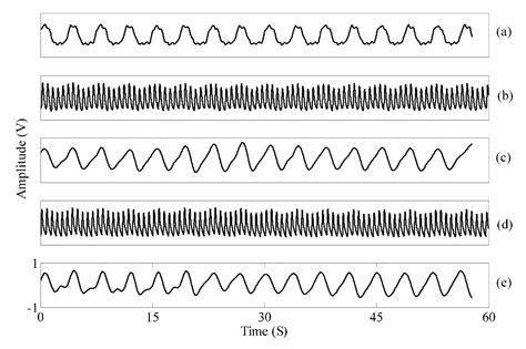 Figure 4 From Extraction Of Respiratory Activity From Ppg And Bp Signals Using Principal