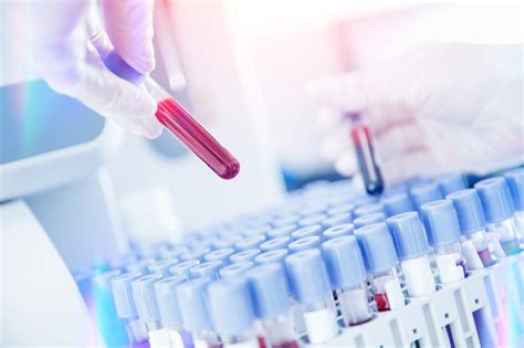 ბაქტერიული ვაგინოზის დიაგნოსტირება გენომიქსი