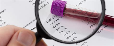 Global Platelet Function Test Industry Surges To A Remarkable Us2170