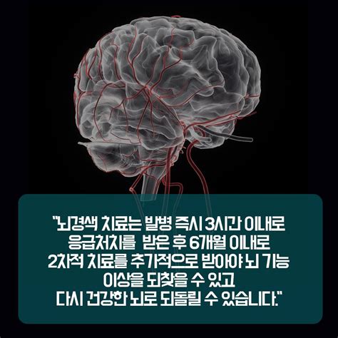 김현수클리닉 뇌경색치료 ﻿줄기세포로 재생과 회복을 기대 뇌경색치료를 위해서는 적절한 시기가 있기