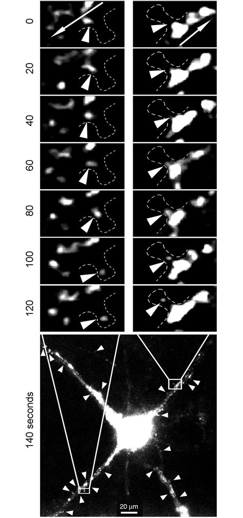 Translocation Of Small Puncta Into Spines Neurons 10 12 Div Were Download Scientific Diagram