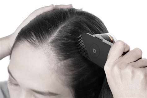 Scalp Camera Design 제품디자인 Smallmark