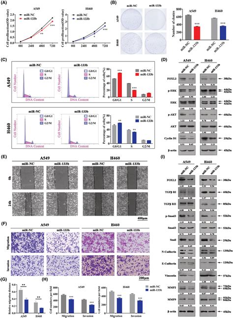Mir‐133b Overexpression Inhibits Cell Proliferation Migration And