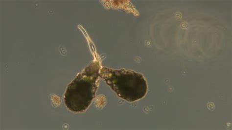 Light Microscope Footage Of Difflugia Pyriformis Testate Amoeba Showing Their Movement In