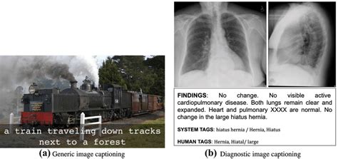 A Caption Produced By The Generic Captioning System Of 100 B Two Download Scientific Diagram