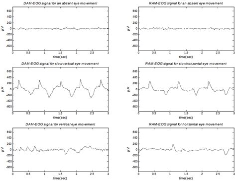 typical eog signals recorded for three situations described in the download scientific diagram