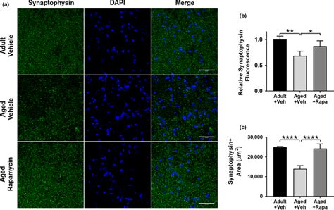 Mtor‐dependent Deterioration Of Presynaptic Density During Aging A