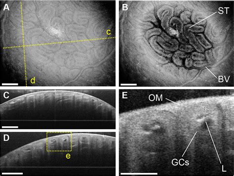 In Vivo Dynamic Volumetric Imaging Of Mouse Testis And Epididymis With Optical Coherence Tomography†