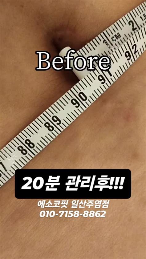 에소코핏 일산점 일산다이어트 일산ems 누워서다이어트 Essocofitilsan • Instagram Photos And Videos