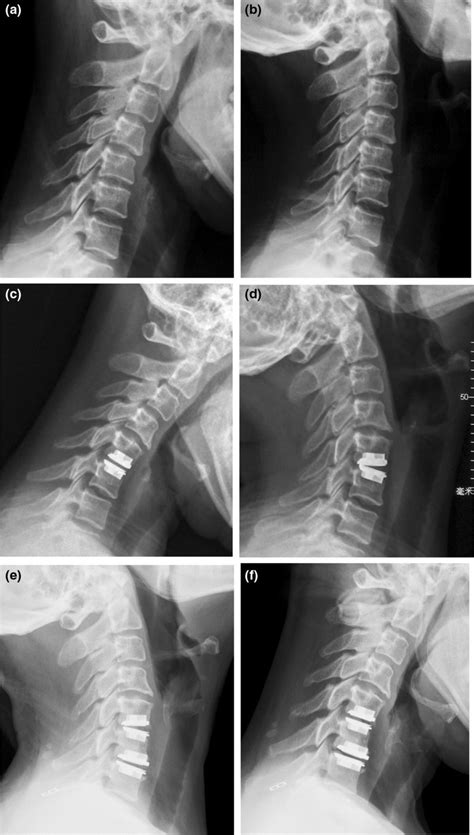 A B A 34 Year Old Female Patient Preoperative Dynamic Download