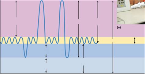 Spirometer Diagram Quizlet