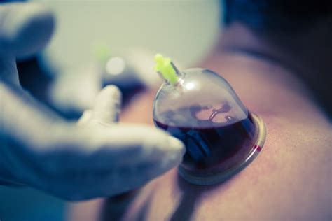 รูปภาพbentusa เลือกดูภาพถ่ายสต็อก เวกเตอร์ และวิดีโอ68 Adobe Stock