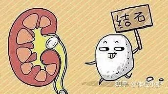 有一种痛叫泌尿系统结石痛 知乎