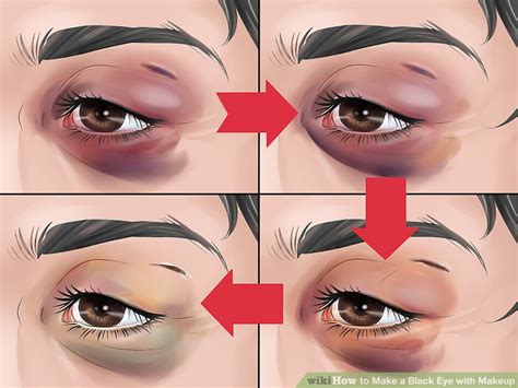 Black Eye Bruise Drawing