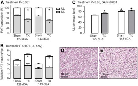 Thyroid Deficiency Before Birth Alters The Adipose Transcriptome To