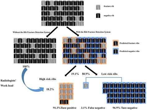 Impact Of The Rib Fracture Detection System In Clinical Practice For