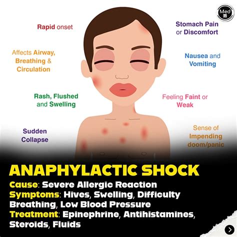Anaphylaxis Shock