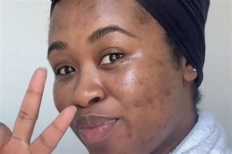 Woman With Beard Says She Loves Her Hairy Chin As