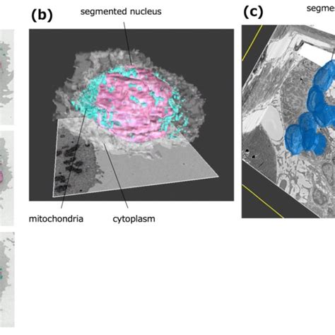 3d Volume Electron Microscopy Images Obtained Using Array Tomography Download Scientific