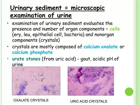 Characteristics Of Urine Pptx