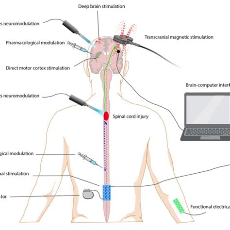 Neuromodulation Approaches For Restoring Function After Spinal Cord