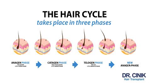 Alopecia Diagram Understanding Forms Of Alopecia Dr U Hair And Skin
