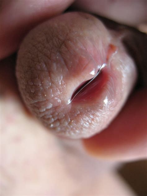 Open Peehole Pics XHamster