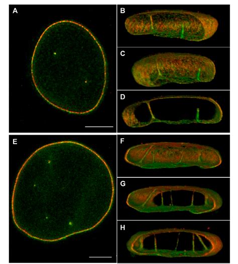 Figure 2 From The Role Of Lamins In The Nucleoplasmic Reticulum A Pleiomorphic Organelle That