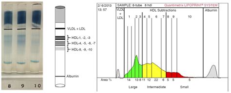 Hdl Subfraction Distribution And Hdl Function In Untreated Dyslipidemic
