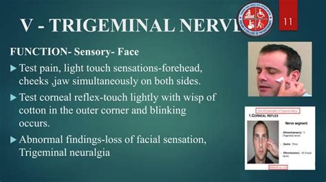 Cranial Nerve Examination PDF