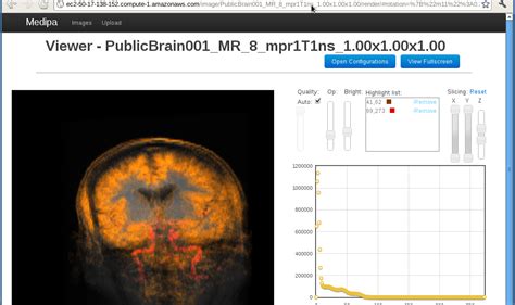 Web Visualization Ncsu Project Medipa