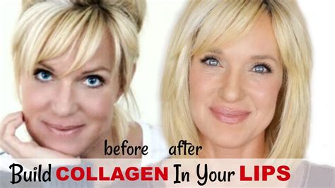 What Does Collagen Do To Your Lips Lipstutorial Org