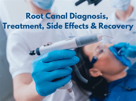 Post Root Canal Recovery Tips For Healing And Pain Management