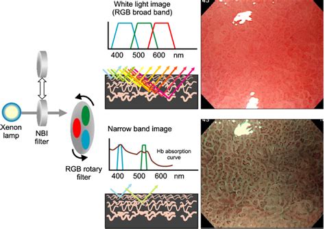 Principle Of The Narrow Band Imaging Nbi System Download Scientific Diagram