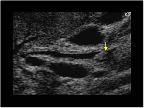 Abdomen And Retroperitoneum 1 2 Gallbladder And Bile Ducts Case 1 2