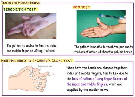 Tests For Median Nerve