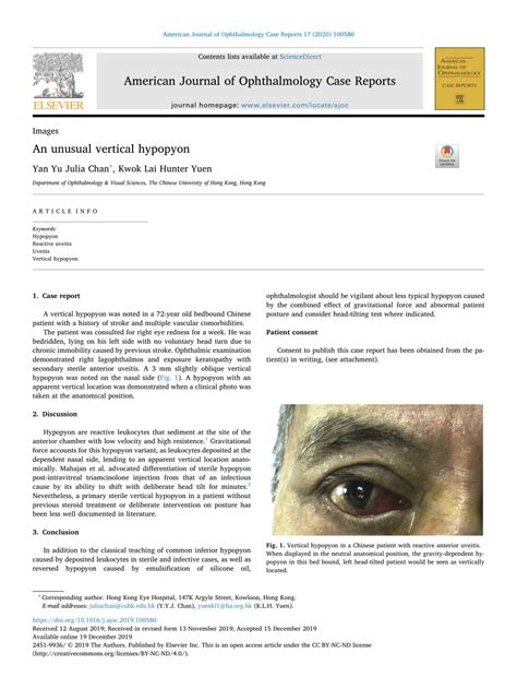 Pdf An Unusual Vertical Hypopyon
