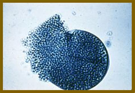 Cocci Chronicles Part Ii Airborne Fungus