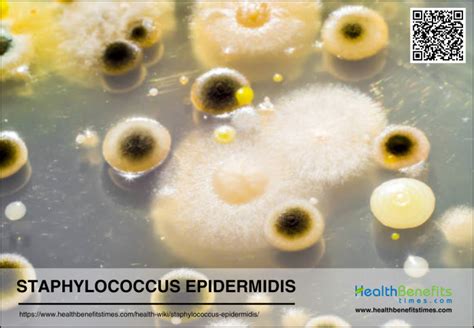 Staphylococcus Epidermidis Health Benefits