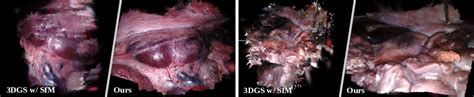 Figure 1 From Free Surgs Sfm Free 3d Gaussian Splatting For Surgical Scene Reconstruction