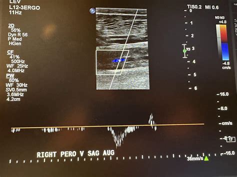Vascular Sonography Ultrasound Physics And Its Application In Medicine