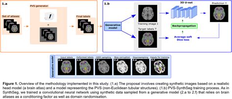 Contrast‐agnostic Deep‐learning‐based Detection Of Perivascular Spaces