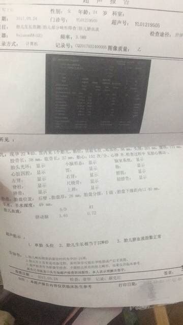 大排畸报告单 大排畸单子 大排畸 大山谷图库