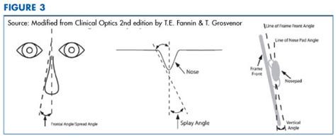 The Well Adjusted Frame