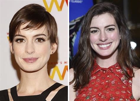 Anne Hathaway Before And After Plastic Surgery Boobs Nose Face Lips