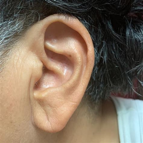 Auricular Medicine By Dr Li Chun Huang Diagnosis Master Tungs