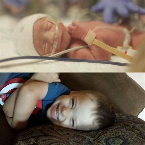 These Photos Of Preemies Then And Now Highlight Their Amazing
