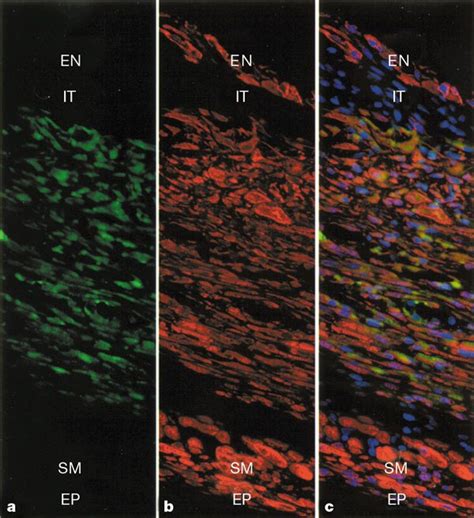 Bone Marrow Cells Regenerate Infarcted Myocardium Nature