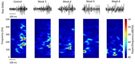 Time Frequency Analysis Emg Samples Corresponding To One Muscular Download Scientific Diagram
